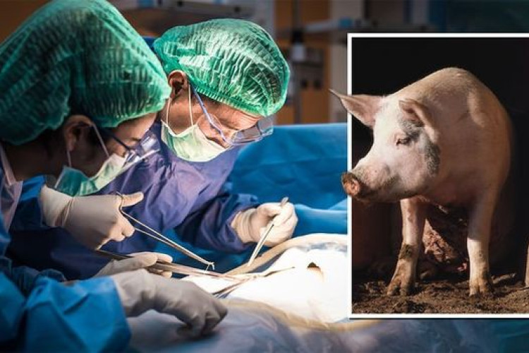 Prva transplantacija bubrega sa svinje na čovjeka